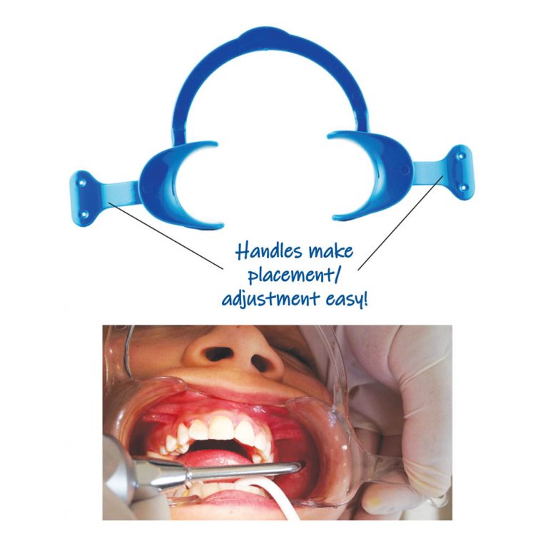 Retractors – Orthodontic Supply & Equipment Company