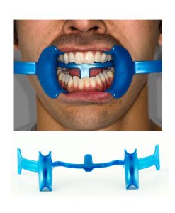 Double Ended Stainless Steel Cheek Retractor – Orthodontic Supply ...
