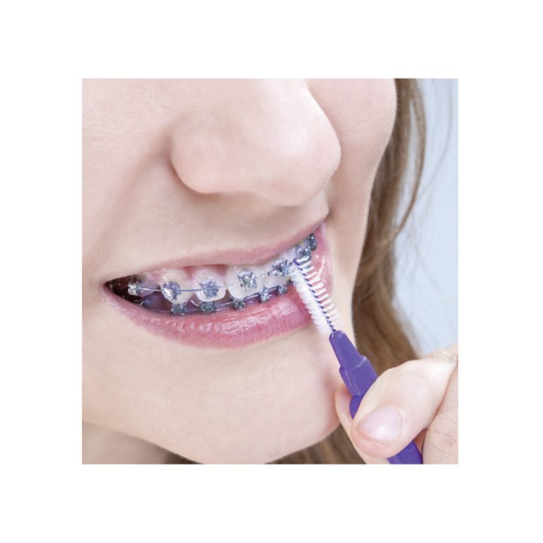 Spiral Interproximal Brushes – Orthodontic Supply & Equipment Company