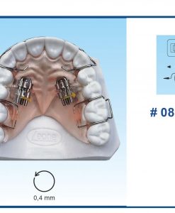 Leone Expansor Series Screws (Acrylic) – Orthodontic Supply & Equipment ...