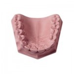 Whip Mix Snap-Stone – Orthodontic Supply & Equipment Company