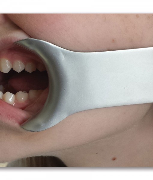 Stainless Steel Retractors | Orthodontic Supply & Equipment Company