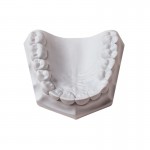 Whip Mix Orthodontic Stone – Orthodontic Supply & Equipment Company