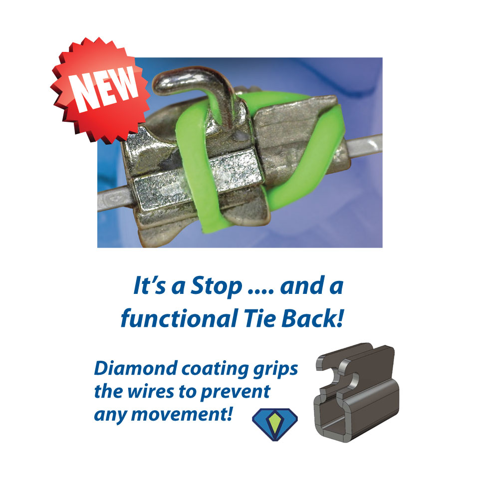 Diamond Crimp Tie Backs – Orthodontic Supply & Equipment Company