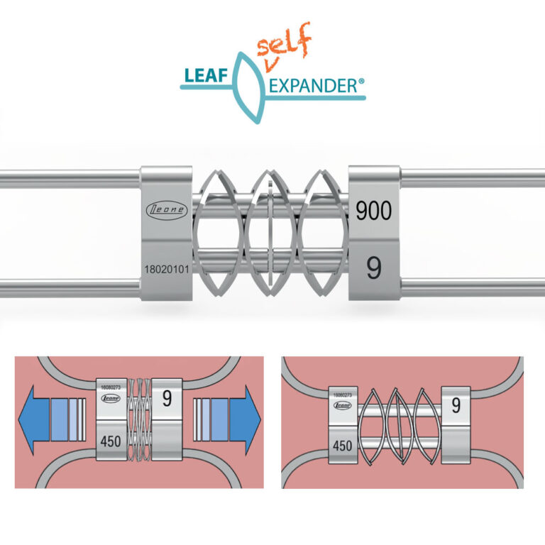 Leone Memoria Leaf Spring Self Expander – Orthodontic Supply ...